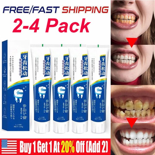 4 PC Loose Teeth Care Toothpaste Gingivitis Treatment & Cavity Repair ...