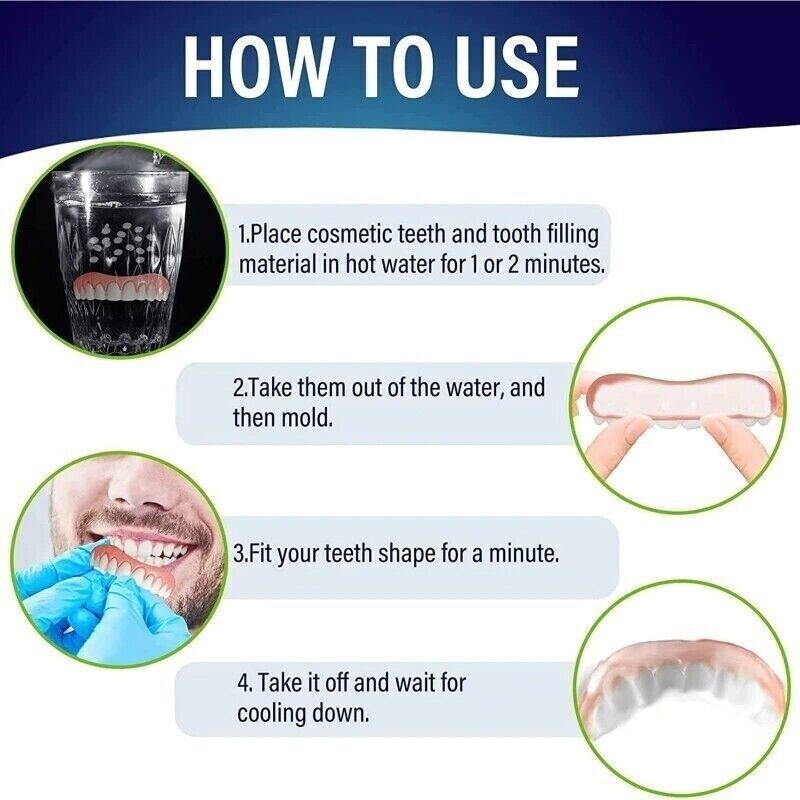 Instant Smile Natural Shade Complete Teeth Makeover Kit, Upper & Lower ...
