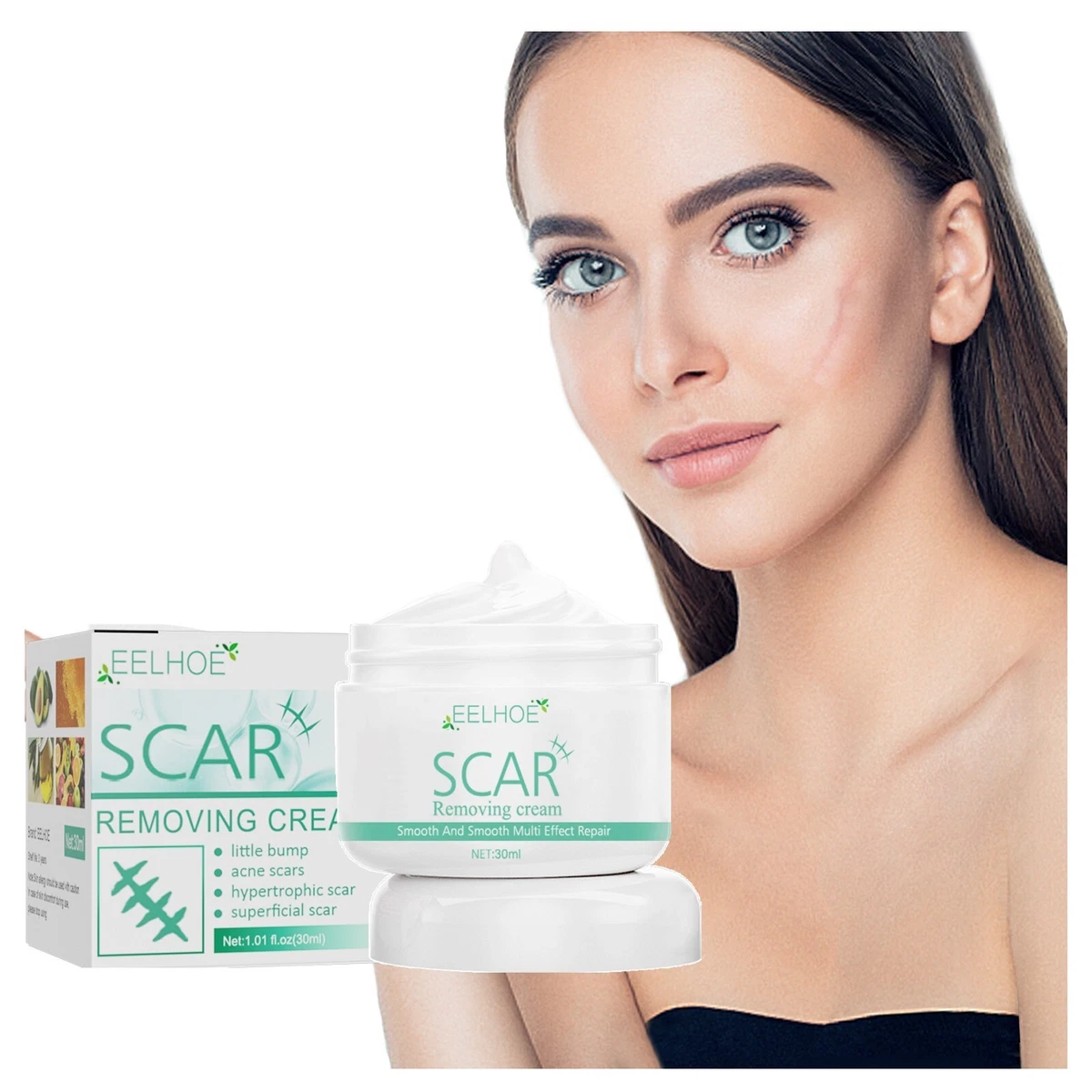 Stretch Marks Removal Cream For Men