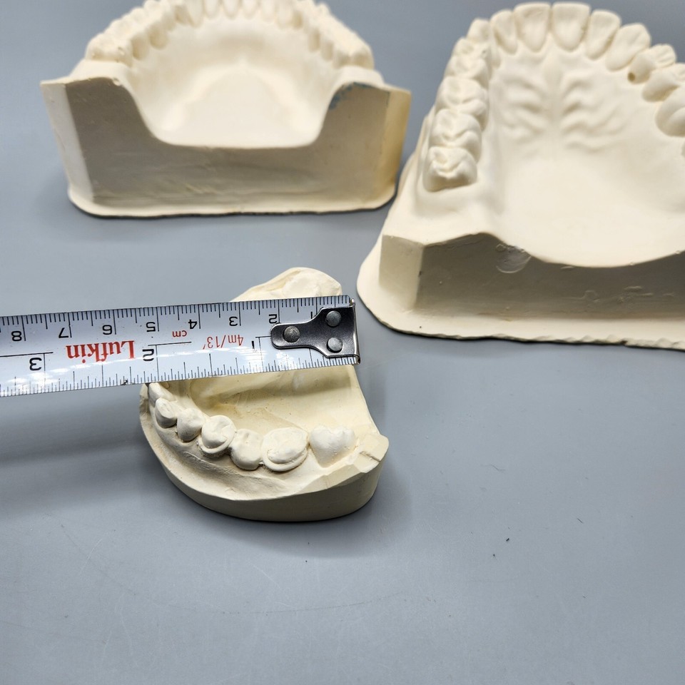Plaster Real Tooth Teeth Dental Molds Dentist Cast Impressions Oddity ...