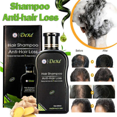 Fast Hair Growth Shampoo For Women Men Anti Hair Loss Treatment Care ...