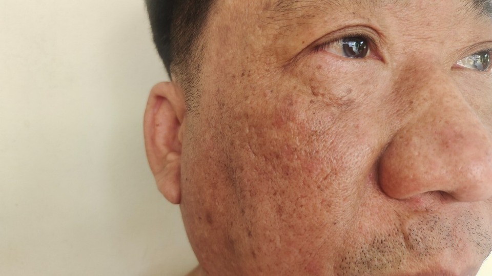 Lemon 4Ever Face Cream – Radiance Boosting Moisturizer with Lemon ...