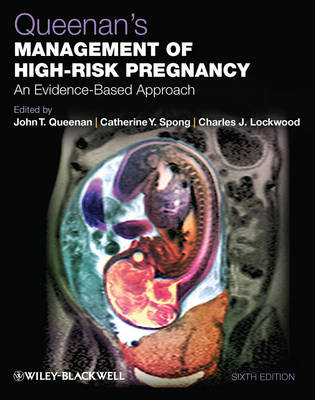 Queenan's Management of High-Risk Pregnancy: An Evidence-Based Approach ...