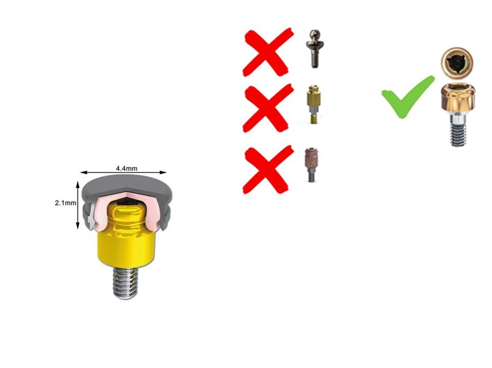 4Pcs US Implant Locator Retention Cap Overdenture Inserts -Pink Male ...