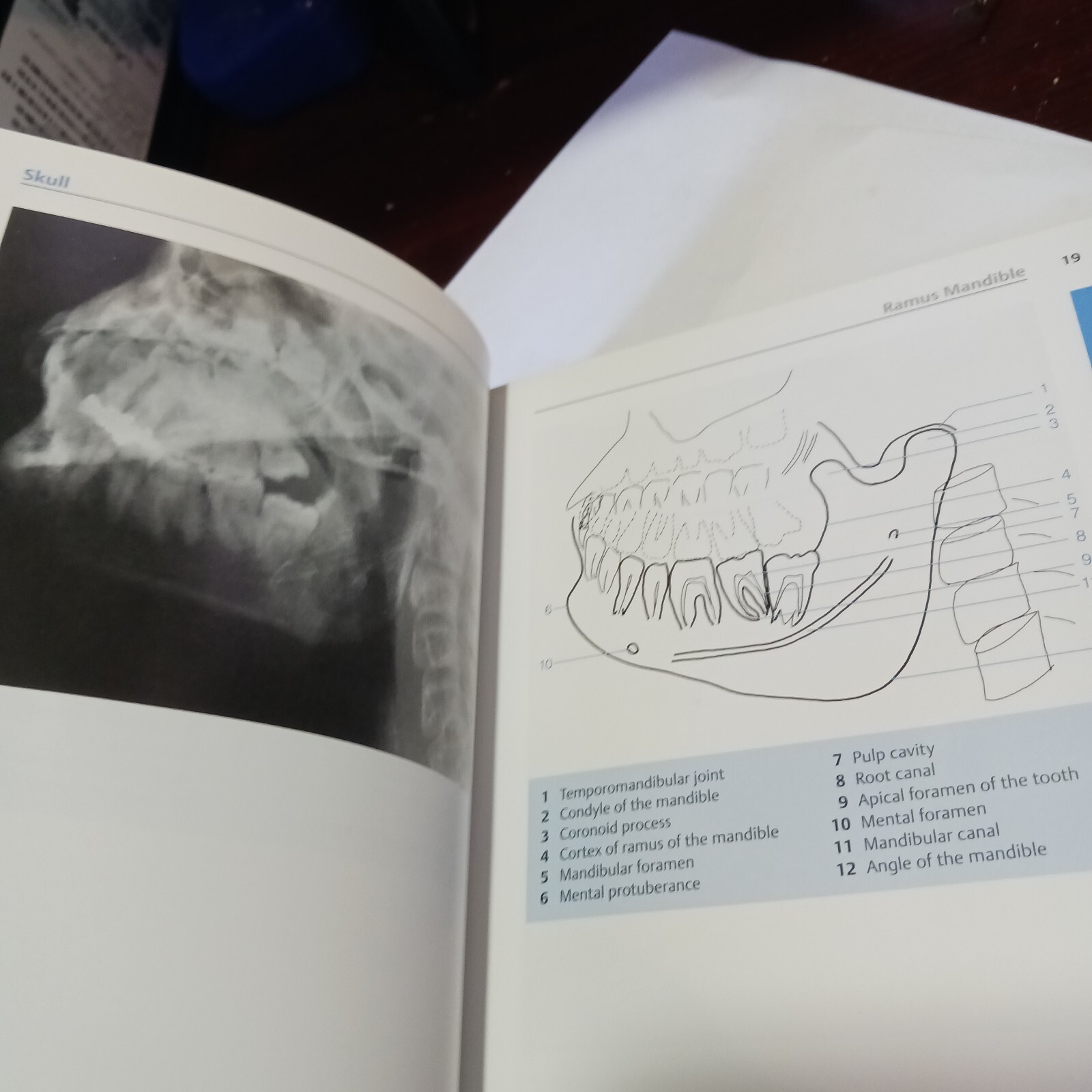 Pocket Atlas of Radiographic Anatomy by Emil Reif and Torsten Bert ...