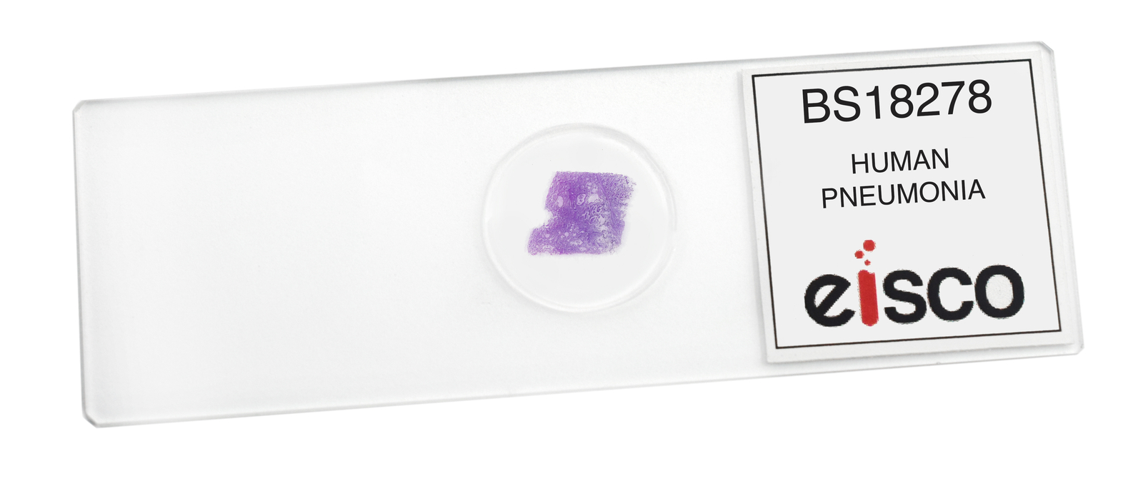 Pneumonia in Human Lungs - Prepared Slide - 75x25mm - Eisco Labs | eBay