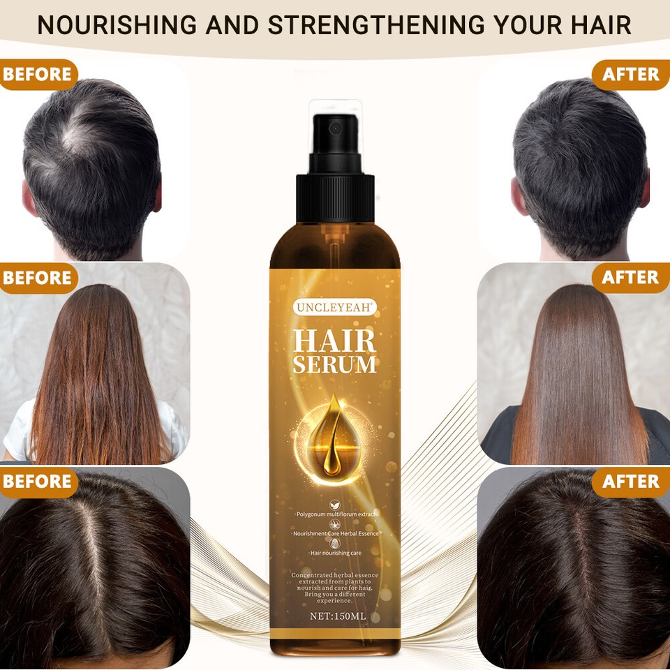 UNCLEYEAH Hair Growth Shampoo & DHT Blocker Anti Hair Loss Treatment ...