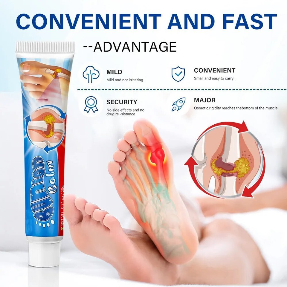2-Pack Sumifun Bunion and Gout Joint Toe Pain Relief Cream Ointment | eBay