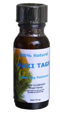 Maxi Natural Tag Skin Remover Take Skin Tag Away Sani Skin Anti ...