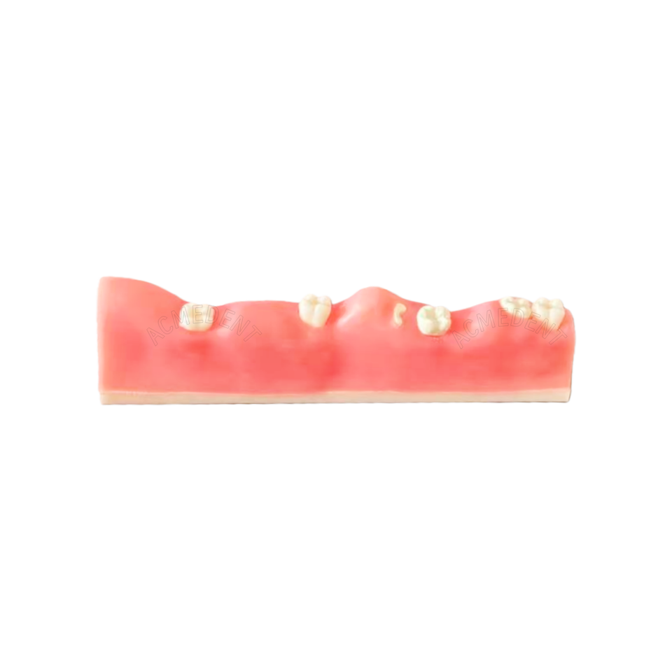 Dental Impacted Tooth Extraction Practice Model Training Gingiva ...