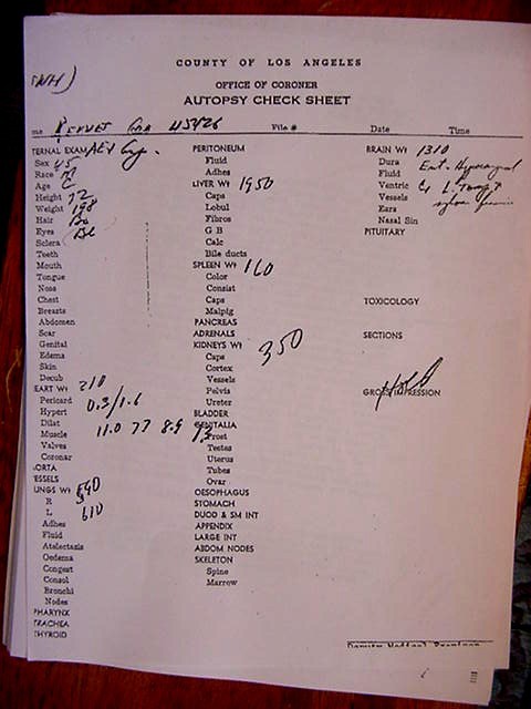 Fotos De La Autopsia De George Reeves