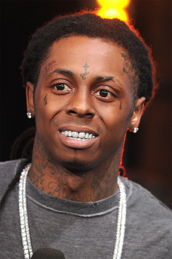 Lil Wayne Teeth Removed