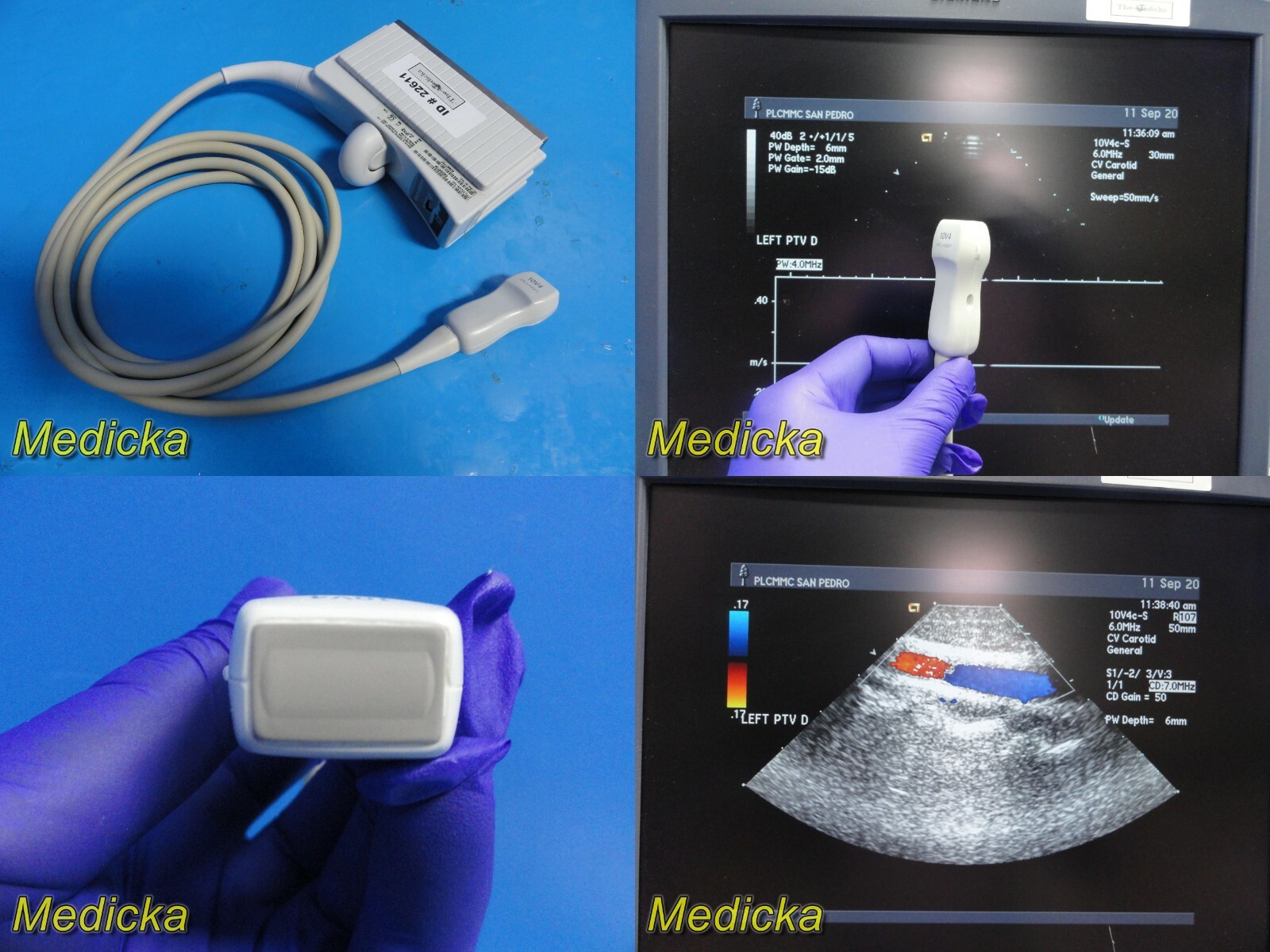 Acuson 10V4 Model 08266709 Vector Array Ultrasound Transducer Probe ...