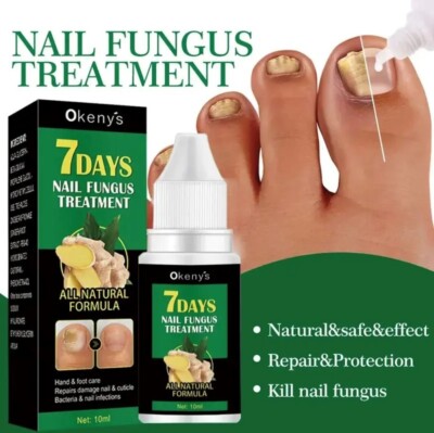 FUNGUS 7 DAYS NAIL FUNGUS TREATMENT ALL NATURAL FORMULA WITH GINGER AND ...