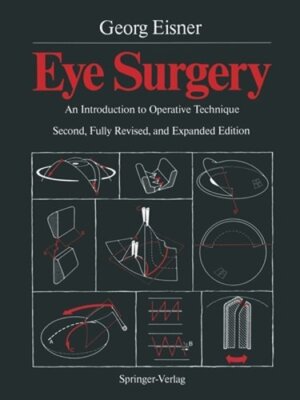 Eye Surgery: An Introduction to Operative Technique by Terry C Telger ...