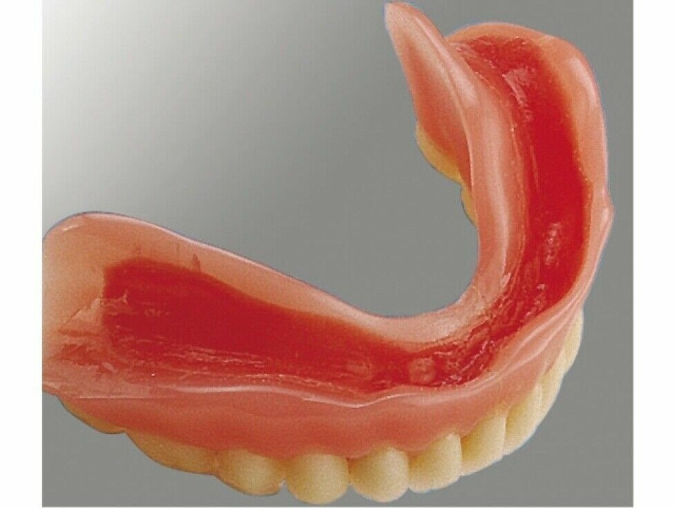 MolloPlast B Silicone Based Permanant Soft Reline Denture Material ...