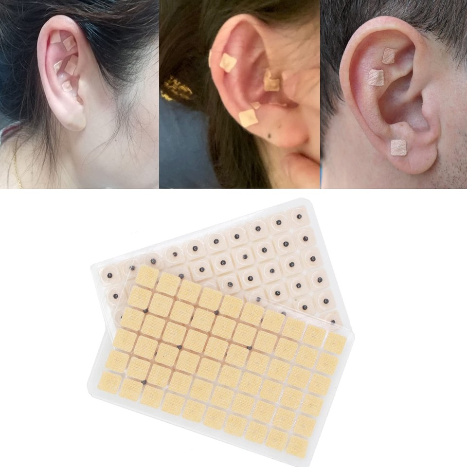 Ear Seeds Auricular Sticker kit,Acupuncture Kit Acupressure with Ears ...