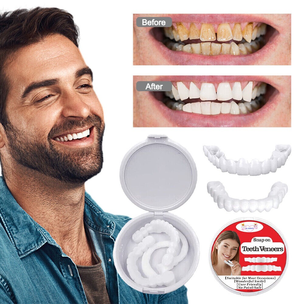 SnapOn Upper Lower False Teeth Dental Veneers Dentures Fake Tooth Cover ...