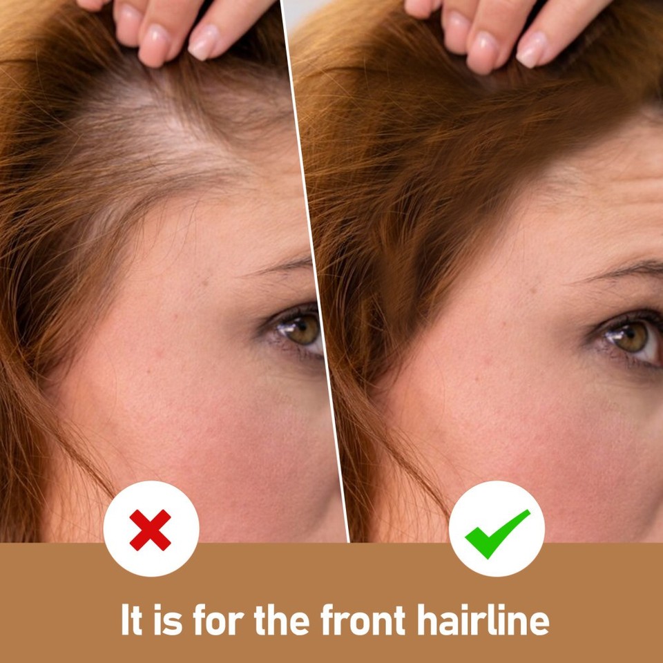 1pc Hair Building Fiber Spray Applicator Professional Hair Thickening ...