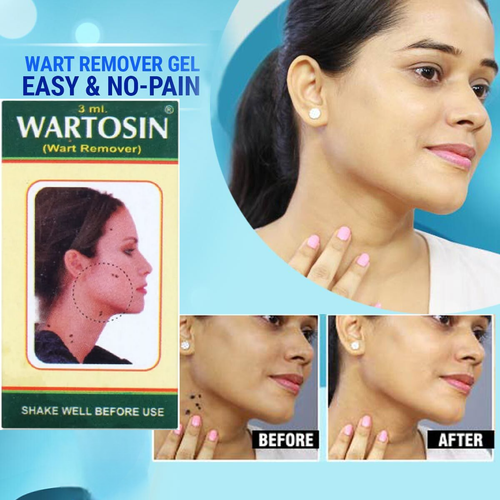 Wartosin fast skin wart remove Unique Herbal Formulation 3ml each (PACK ...