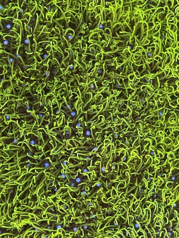 WWC Long Green Star Polyp "Neon Green Star Polyps" (4in frag) *read ...