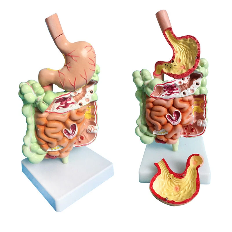 Digestive System Model For Kids