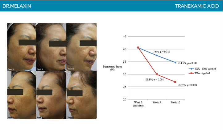 Dr.Melaxin TX Measles Cream 50ml 1.69oz | eBay
