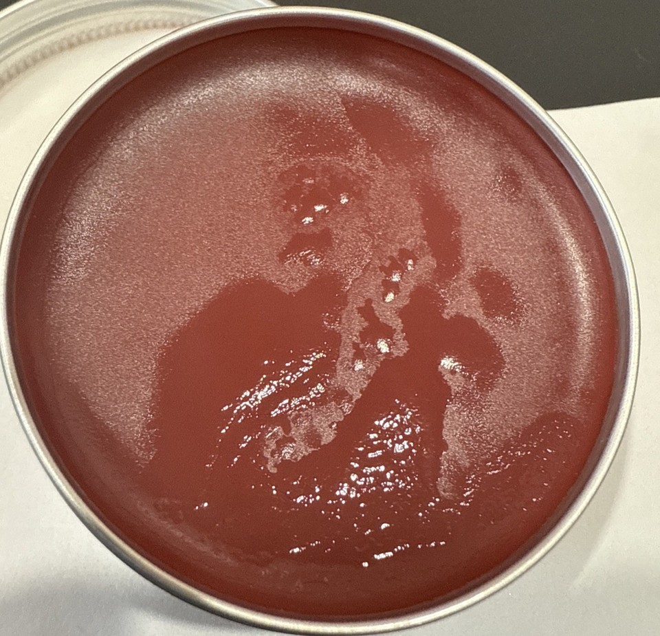 Senzio Miracle-Balm Soothing Joint Cream for Back & Body Varicose-Veins ...