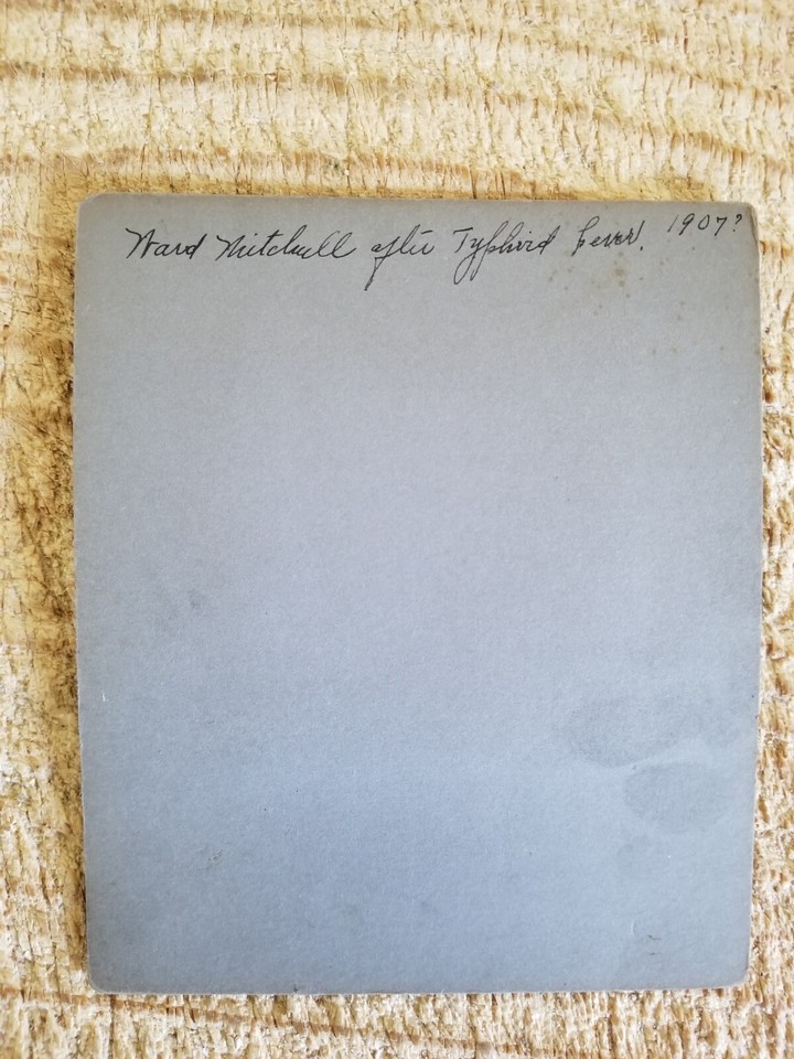 MAN IDENTIFIED AFTER TYPHOID FEVER,1907.VTG 3.3" x 3.3" PHOTO ON CARD ...