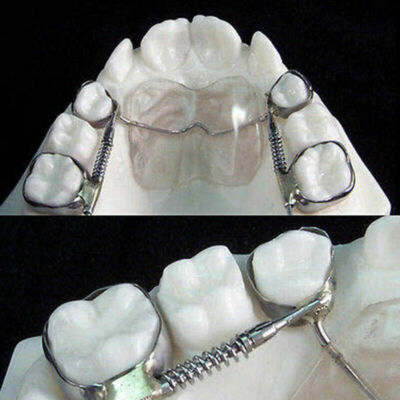 1 Set Molar Distalizer Dental Orthodontic Archwire Buccal Tube Braces ...