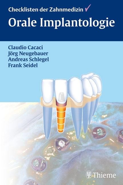 Checkliste Orale Implantologie | Cacaci, Claudio | Schlegel, Andreas ...