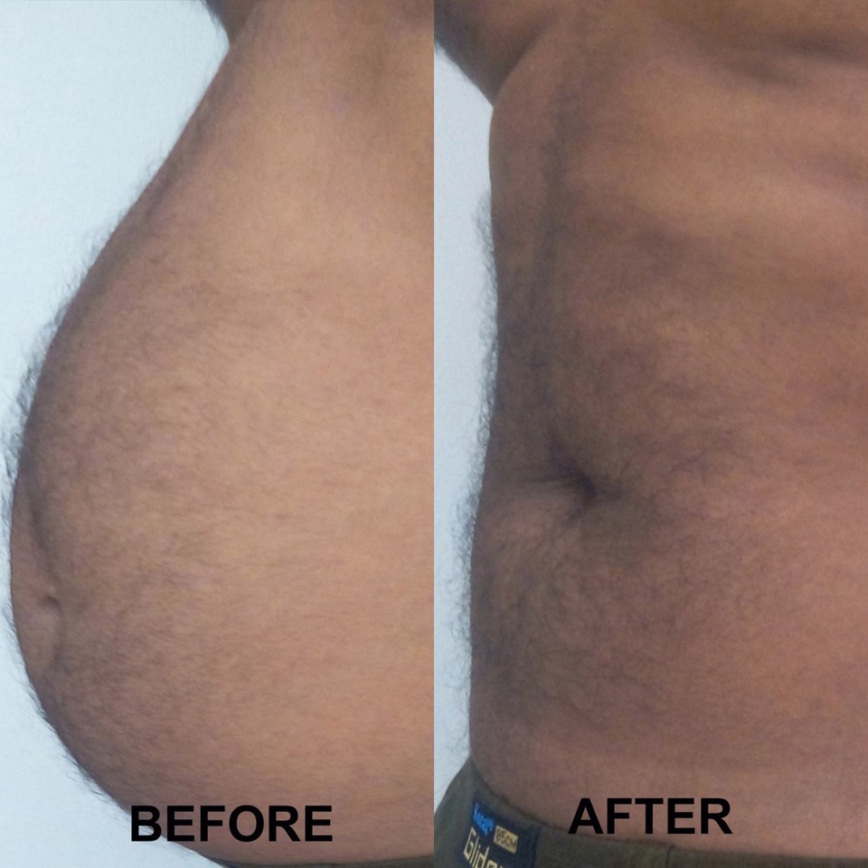 Tummy oil / Tummy Reducer / Tummy Trimmer / Fat Reducer / Weight ...