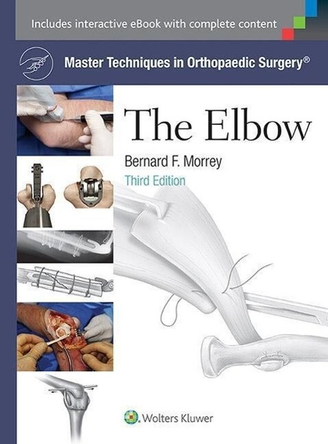 Master Techniques in Orthopaedic Surgery: The Elbow von Bernard F ...