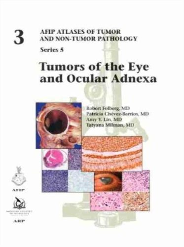 Patricia Chévez-Barrios Amy Y. Lin Tatyana Millman Tumors of the Eye an ...