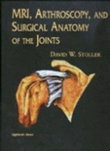 MRI, Arthroscopy, and Surgical Anatomy of the Joints by Stoller: Used ...