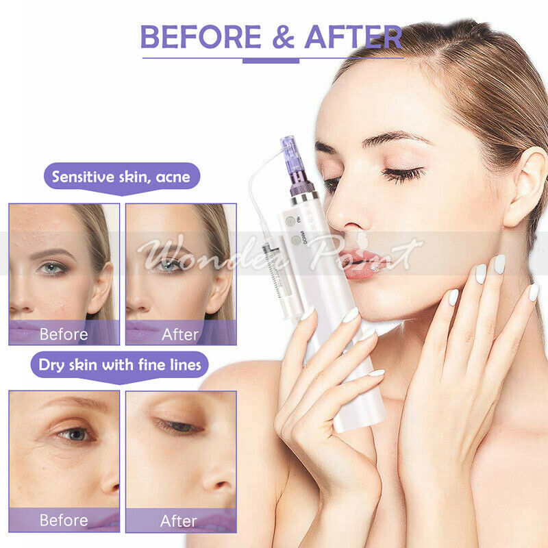 Water Meso Gun Mesotherapy Hydra Skin Facial Pen Machine Hydrolifting ...