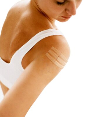 Steri Strips Wound Closure Nexcare, Steri-Strip Wound Closure, 30 ...