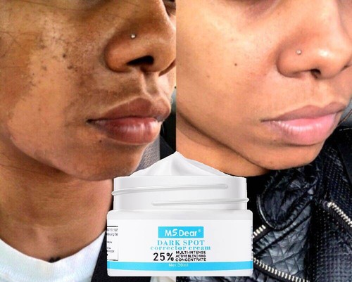 Buy Black Dark Skin Permanent Whitening Lightening Brightening ...