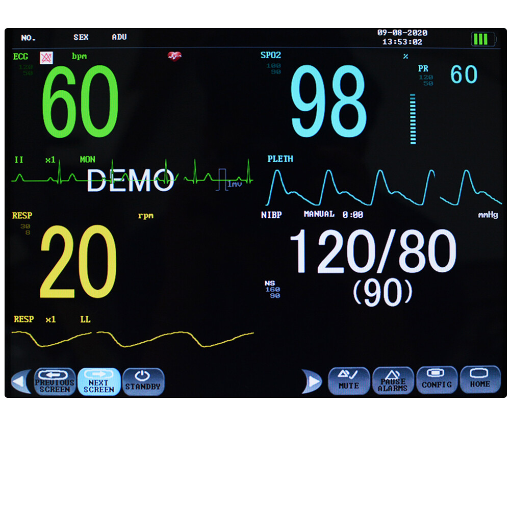 Ecg Monitor Screen