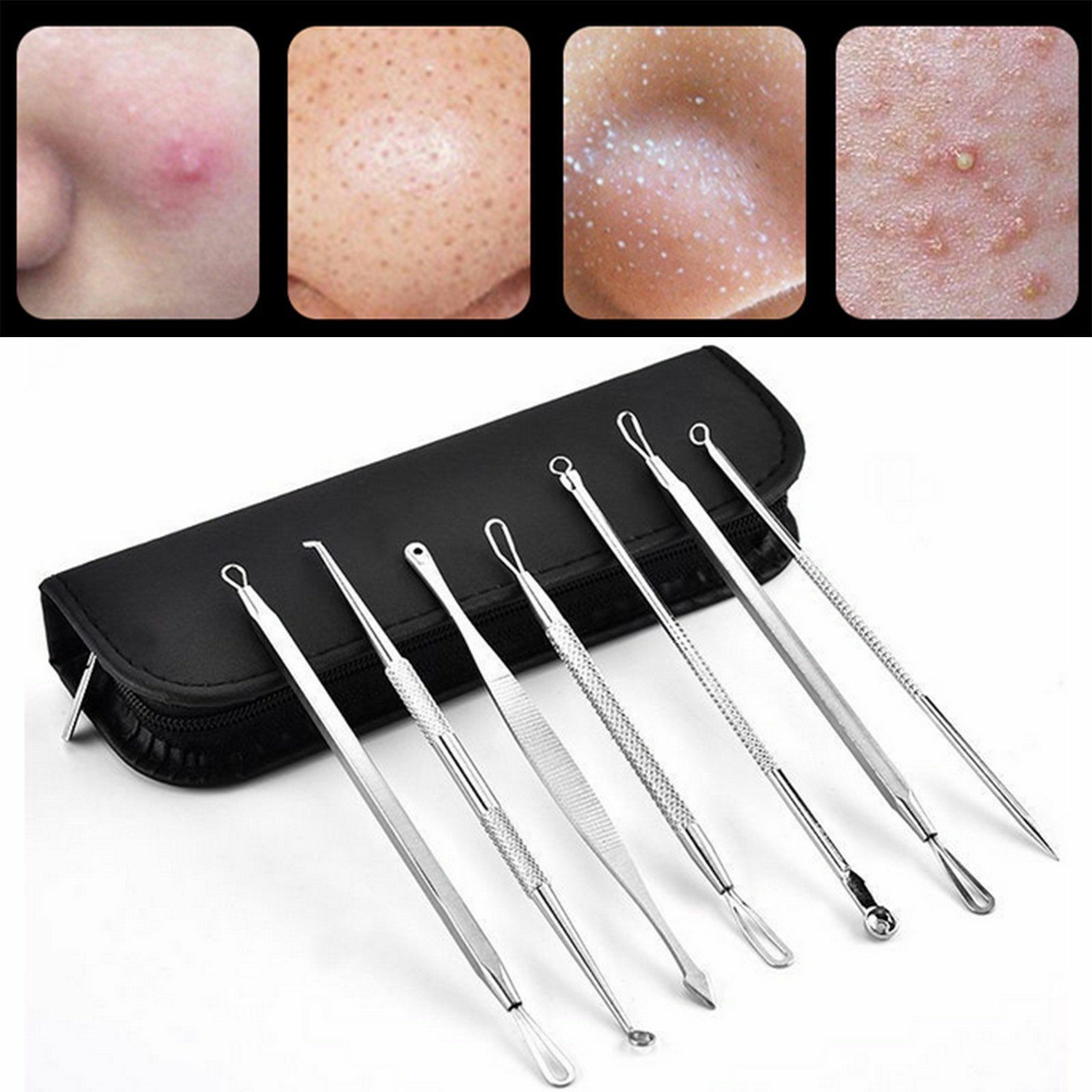 7Pcs Set Blackhead Remover Comedone Blemish Pimple Extractor Tool Kit ...