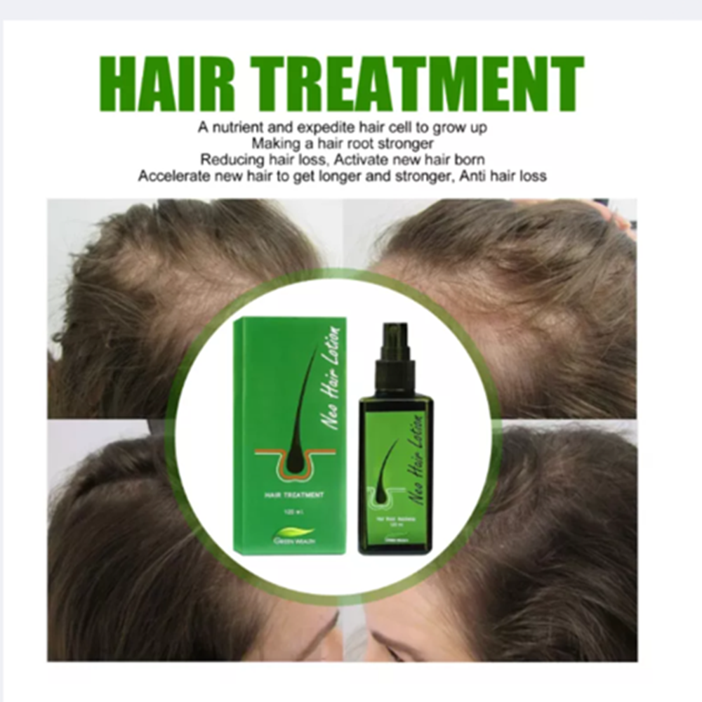 Neo Hair Lotion Hair Root Treatment Original Nutrients Longer Hair ...