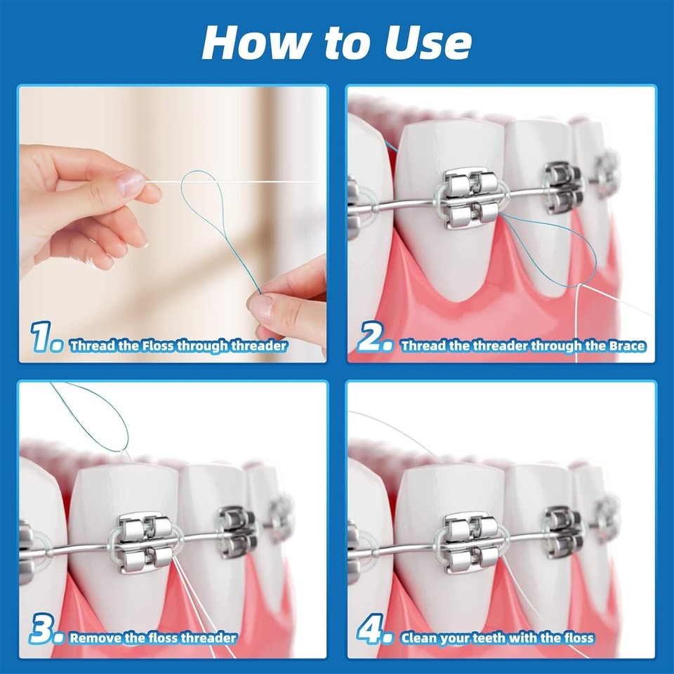 200 Count Simple Dental Floss Threaders for Braces Bridges Implants ...