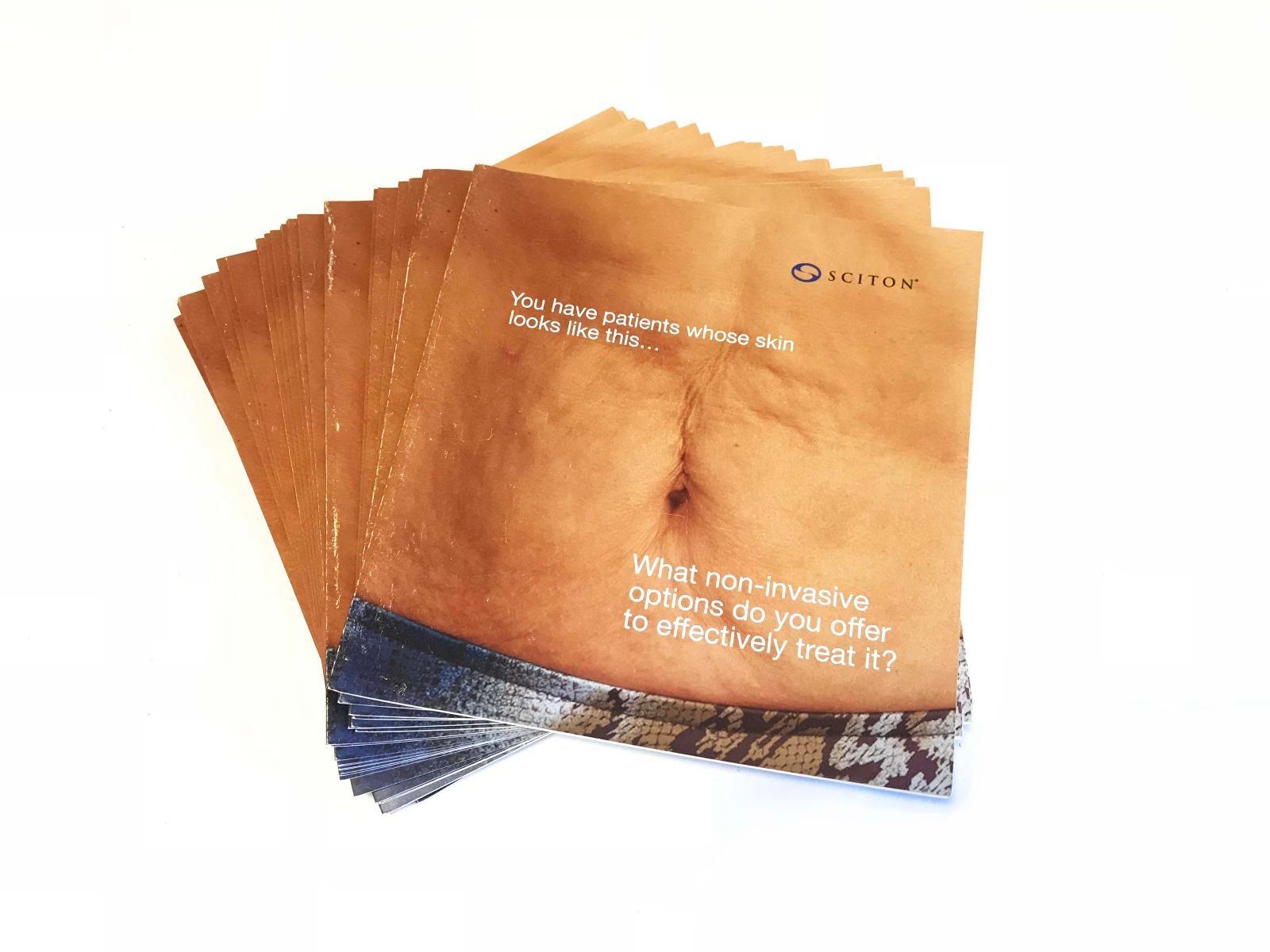 Sciton Joule SkinTyte BBL IPL Skin Firming Stomach Device Brochures ...