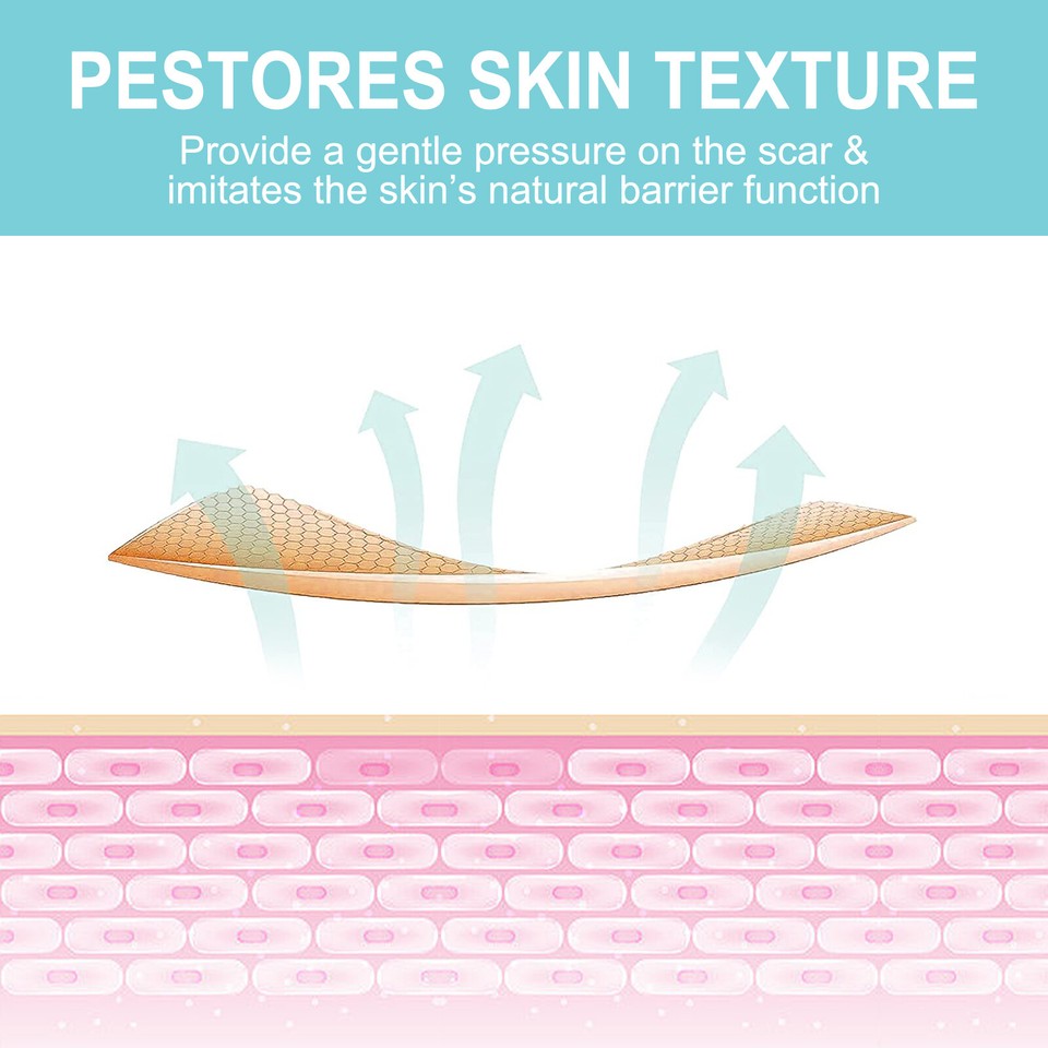 Scar Silicone Sheet Gel Patch Removal Skin Treatment Repair Wound Burn ...