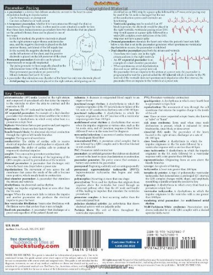 EKG/ECG Quick Study Guide | eBay