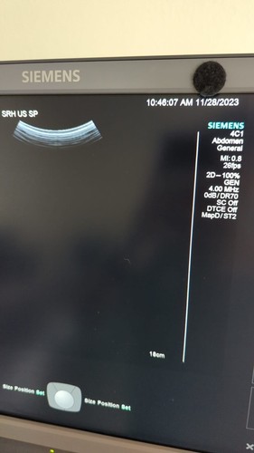 SIEMENS ACUSON 4C1 ABDOMINAL ULTRASOUND TRANSDUCER / PROBE SN: 70705004 ...