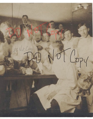 1870’s OLD Macabre Human Dissection Cadaver Photo- Medical Students ...