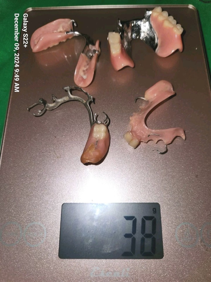 Metal Partial Dentures, Dental Teeth, Dentist White Metal Scrap ...