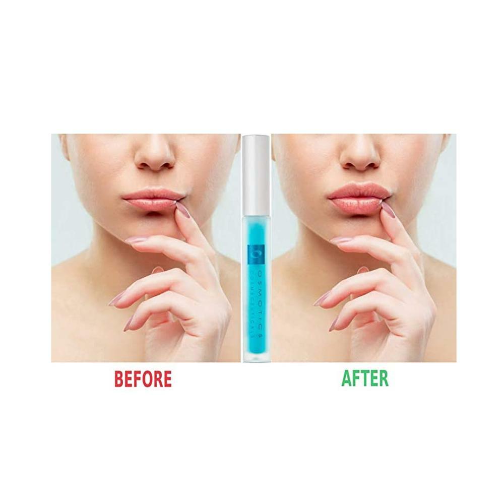 cheap mail order Osmotics Cosmeceuticals Blue Copper 5 Lip & Tuck Lip ...