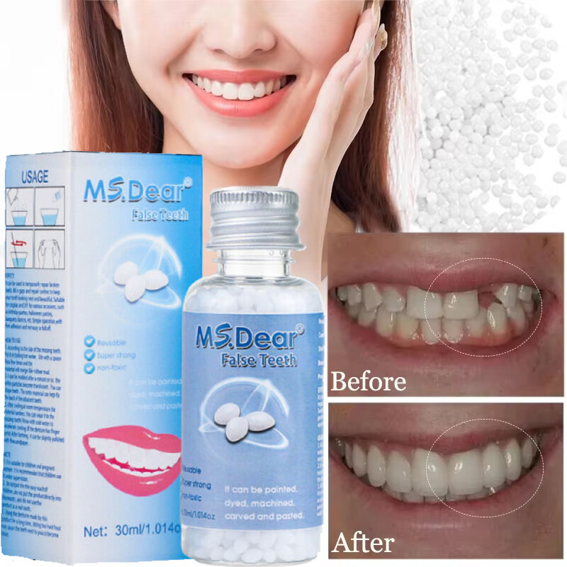 Temporary Tooth Repair Kit Temp Dental Repair Replace Missing Teeth DIY ...
